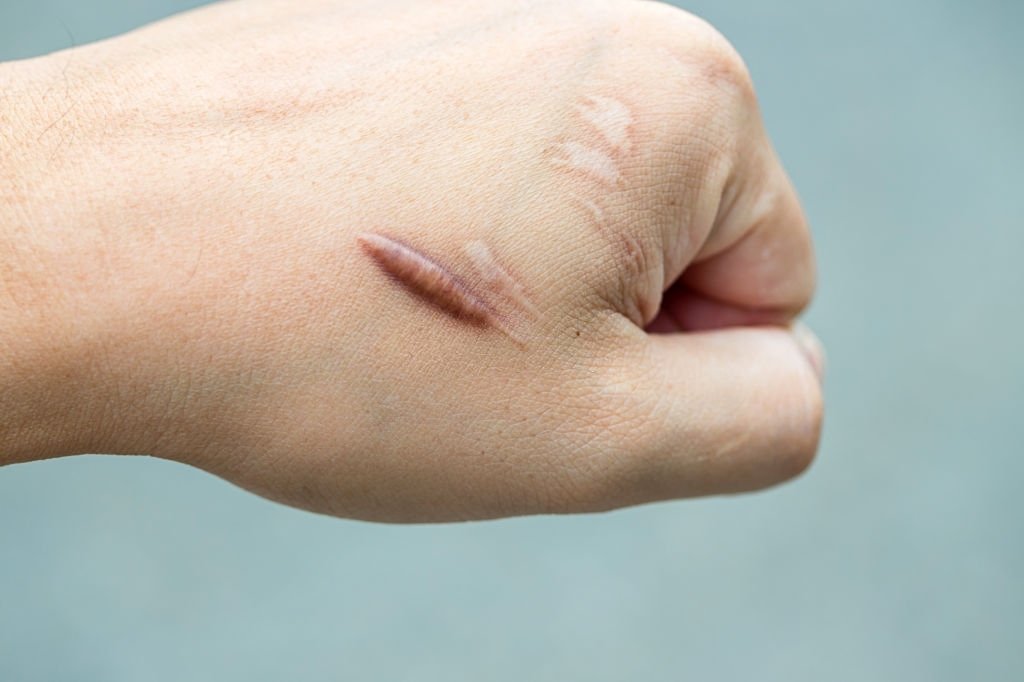 Tips For Using Makeup To Cover Scars Best Shopping Guide Tips For Using Makeup To Cover Scars Best Shopping Guide